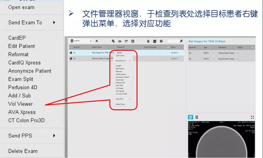 CT界的航母—GE Revolution CT “修炼秘籍” - 瑞派西医疗官网(CT \MRI\球管维修及销售专家)