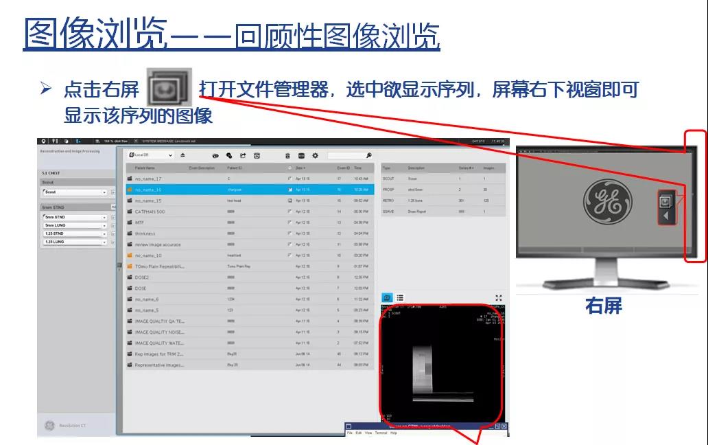 CT界的航母—GE Revolution CT “修炼秘籍” - 瑞派西医疗官网(CT \MRI\球管维修及销售专家)