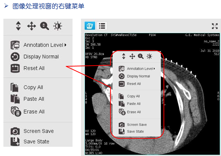 CT界的航母—GE Revolution CT “修炼秘籍” - 瑞派西医疗官网(CT \MRI\球管维修及销售专家)